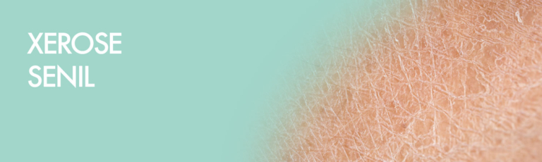 XEROSE SENIL – Dra Roseli Andrade